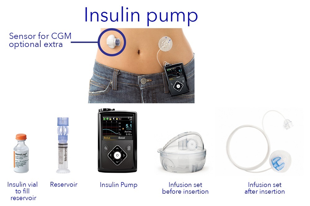 DREAMED DIABETES: New FDA Clearance Paves The Way to Optimization of ...